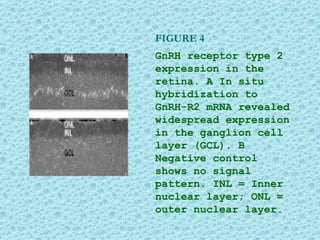 Visual processing in_vertebrate_retina | PPT