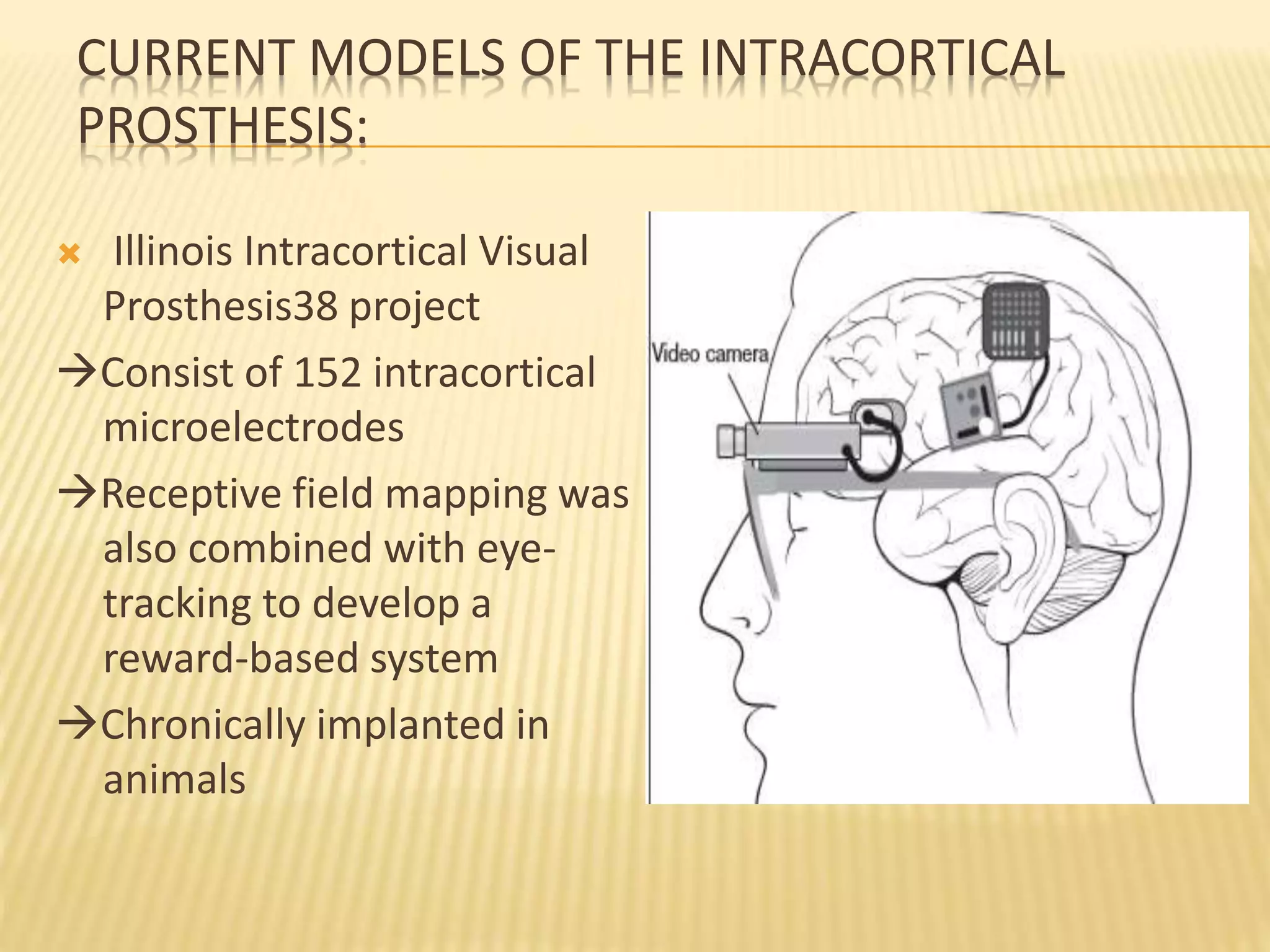 Visual prosthesis | PPTX