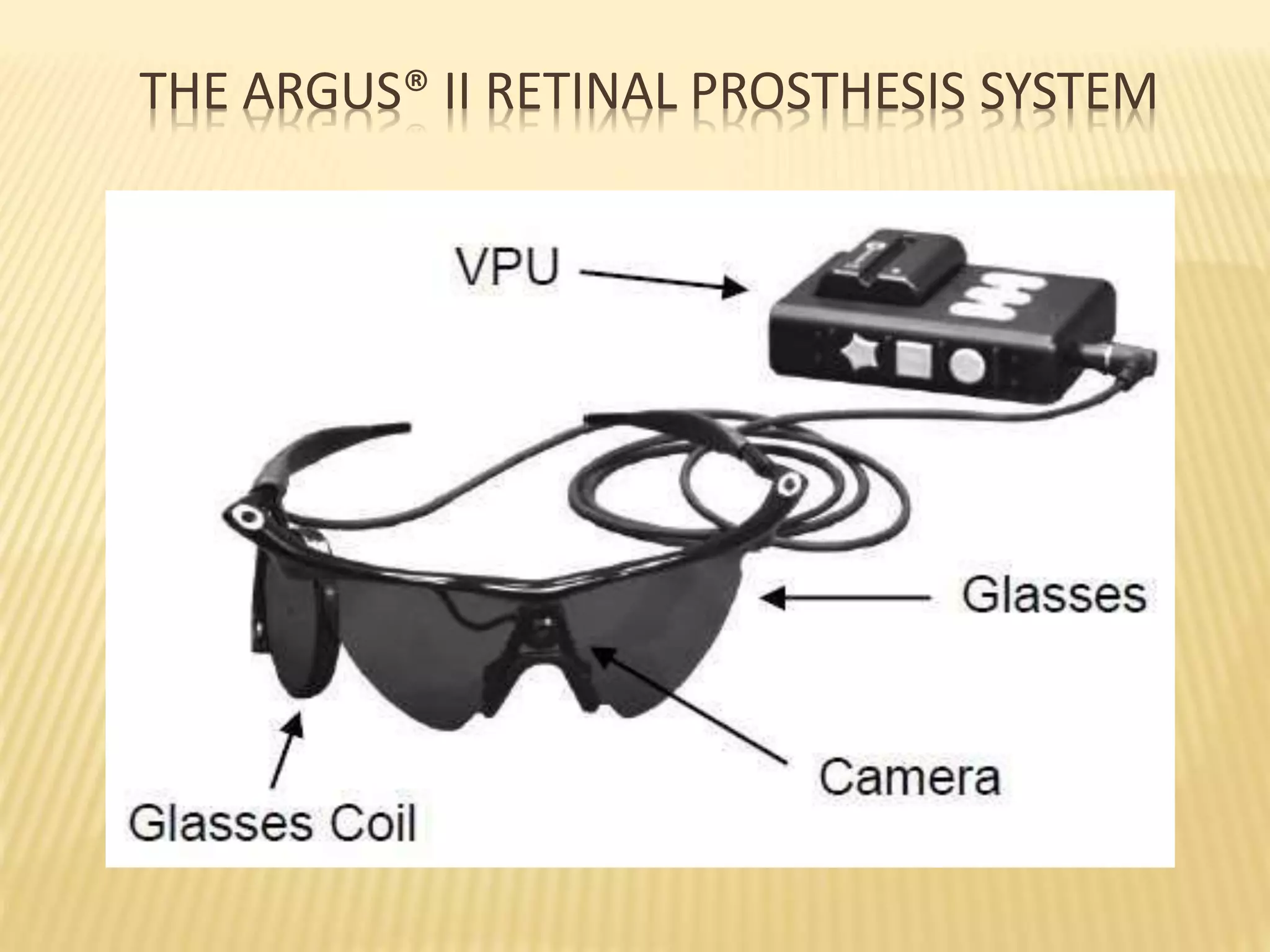 Visual prosthesis | PPTX