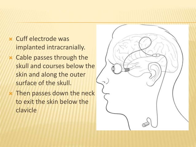 Visual prosthesis | PPTX