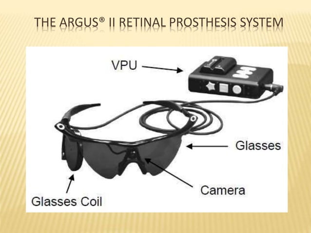 Visual prosthesis | PPTX