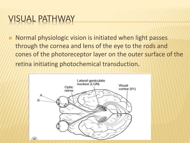 Visual prosthesis | PPTX