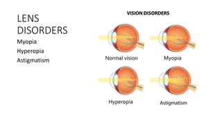 VISUAL REFLEXES.pptx