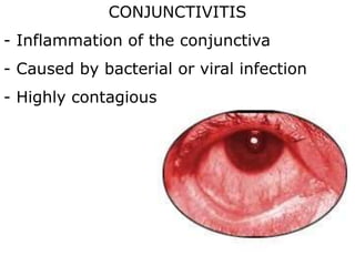 visual sense eye structures of eye anatomy of eye .pptx