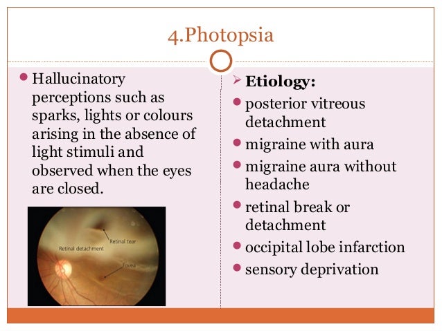 Visual Symptomology from Optometrist Point of View