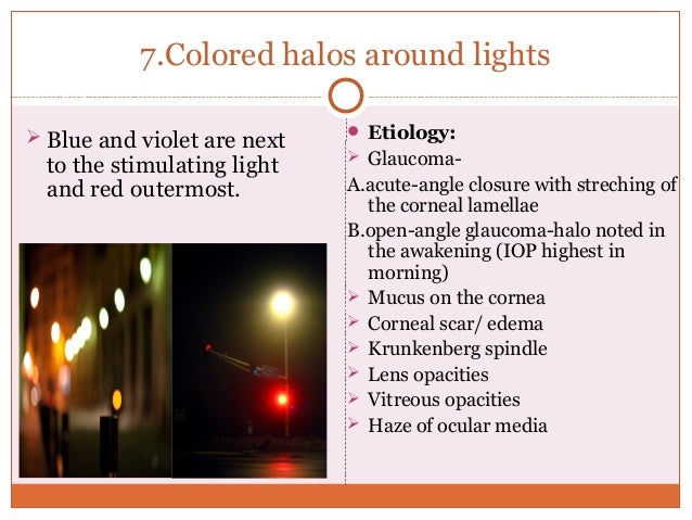 Visual Symptomology from Optometrist Point of View