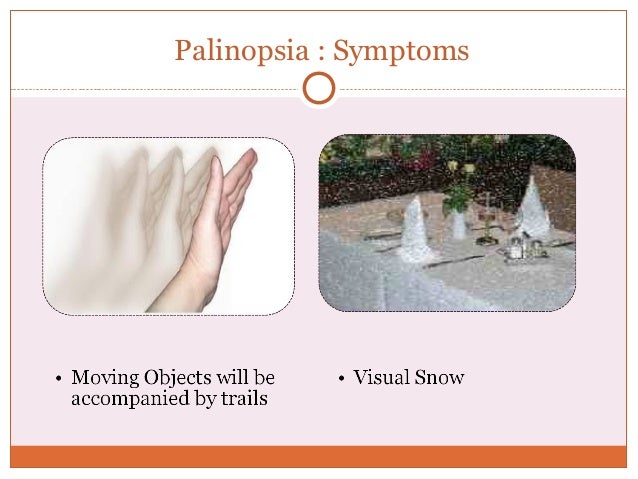 Visual Symptomology from Optometrist Point of View