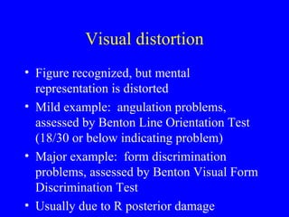 Visual system | PPT