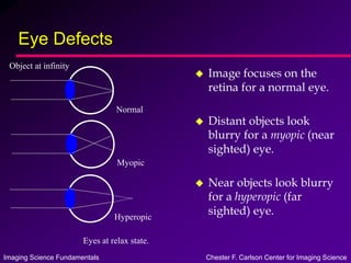 VisualSystemAnatomy.ppt