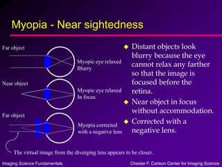 VisualSystemAnatomy.ppt