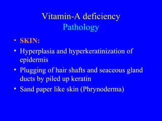 Phrynoderma Vitamin A Deficiency
