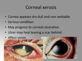 Vit A and vit a deficiencydisorders.pptx