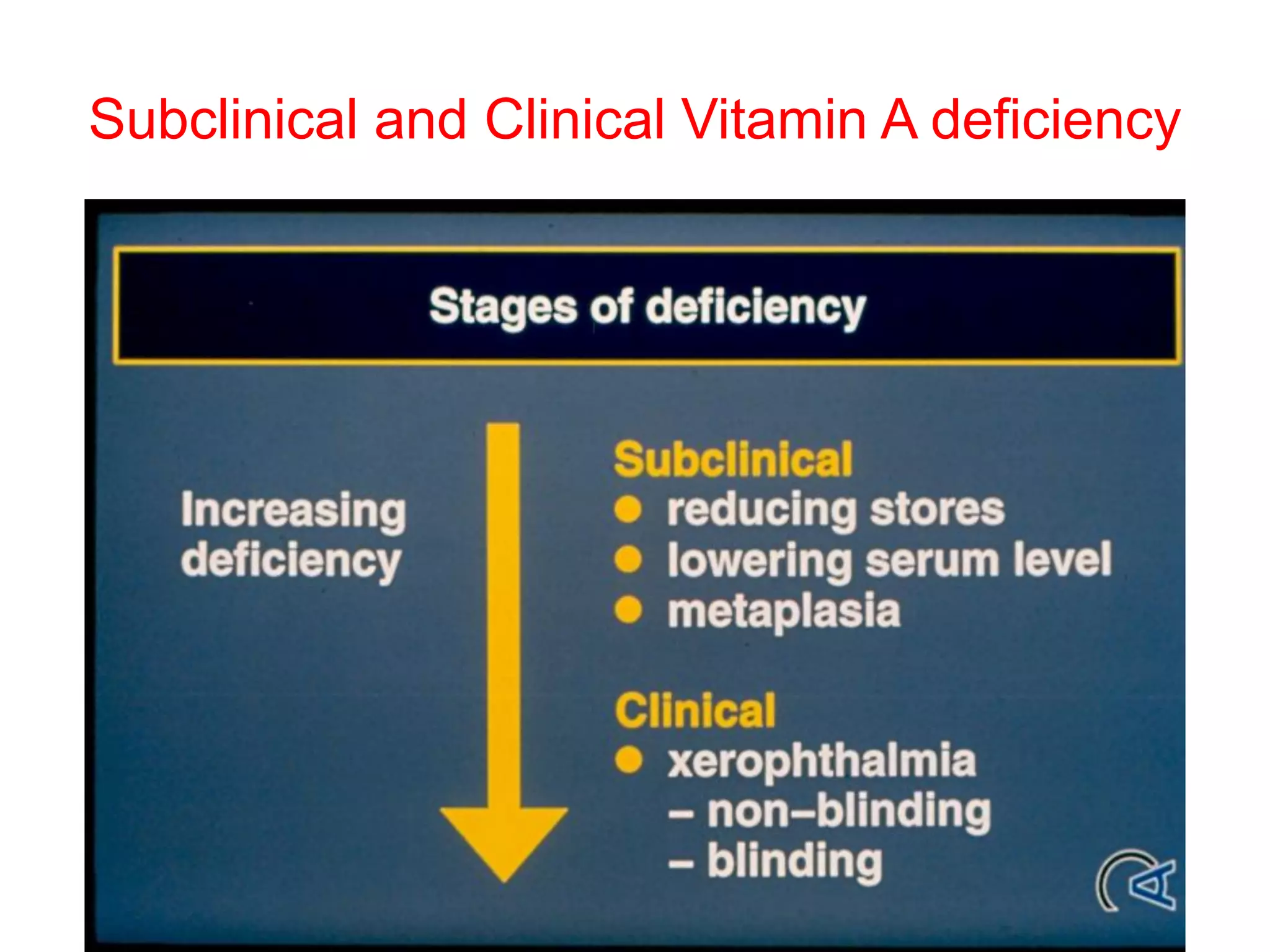 Vit a deficiency 2021 | PPT