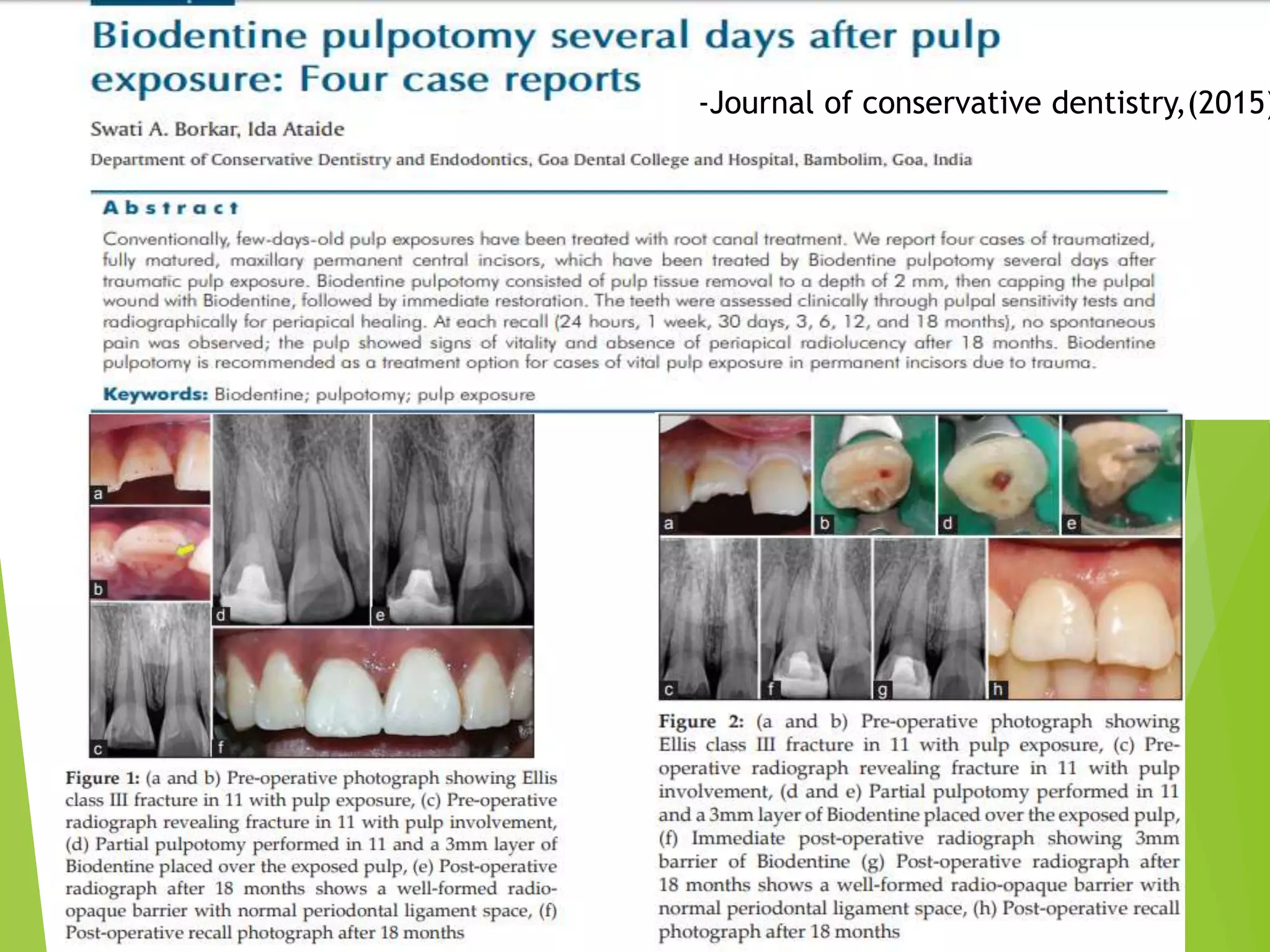 Vital pulp therapy | PPTX | Dental Health | Diseases and Conditions
