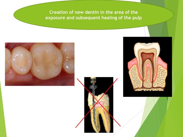 Vital pulp therapy | PPTX | Dental Health | Diseases and Conditions