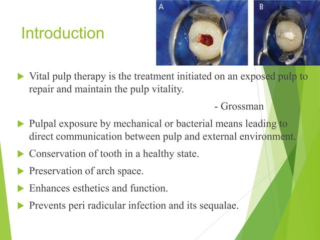 Vital pulp therapy | PPTX | Dental Health | Diseases and Conditions