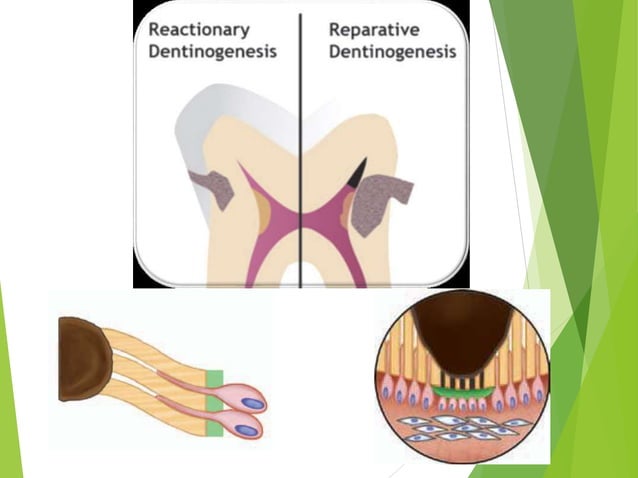 Vital pulp therapy | PPTX | Dental Health | Diseases and Conditions