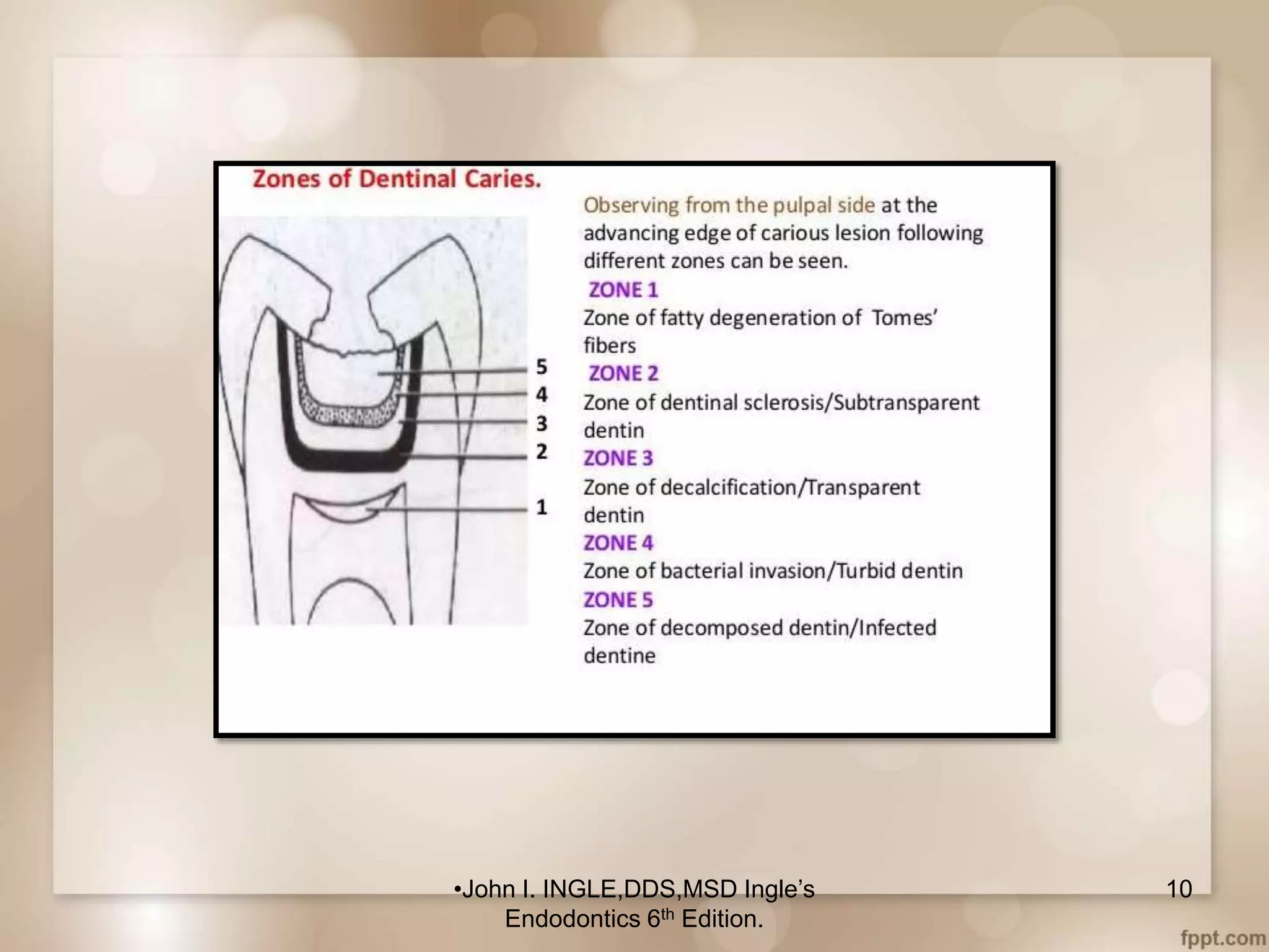Vital Pulp Therapy | PPT