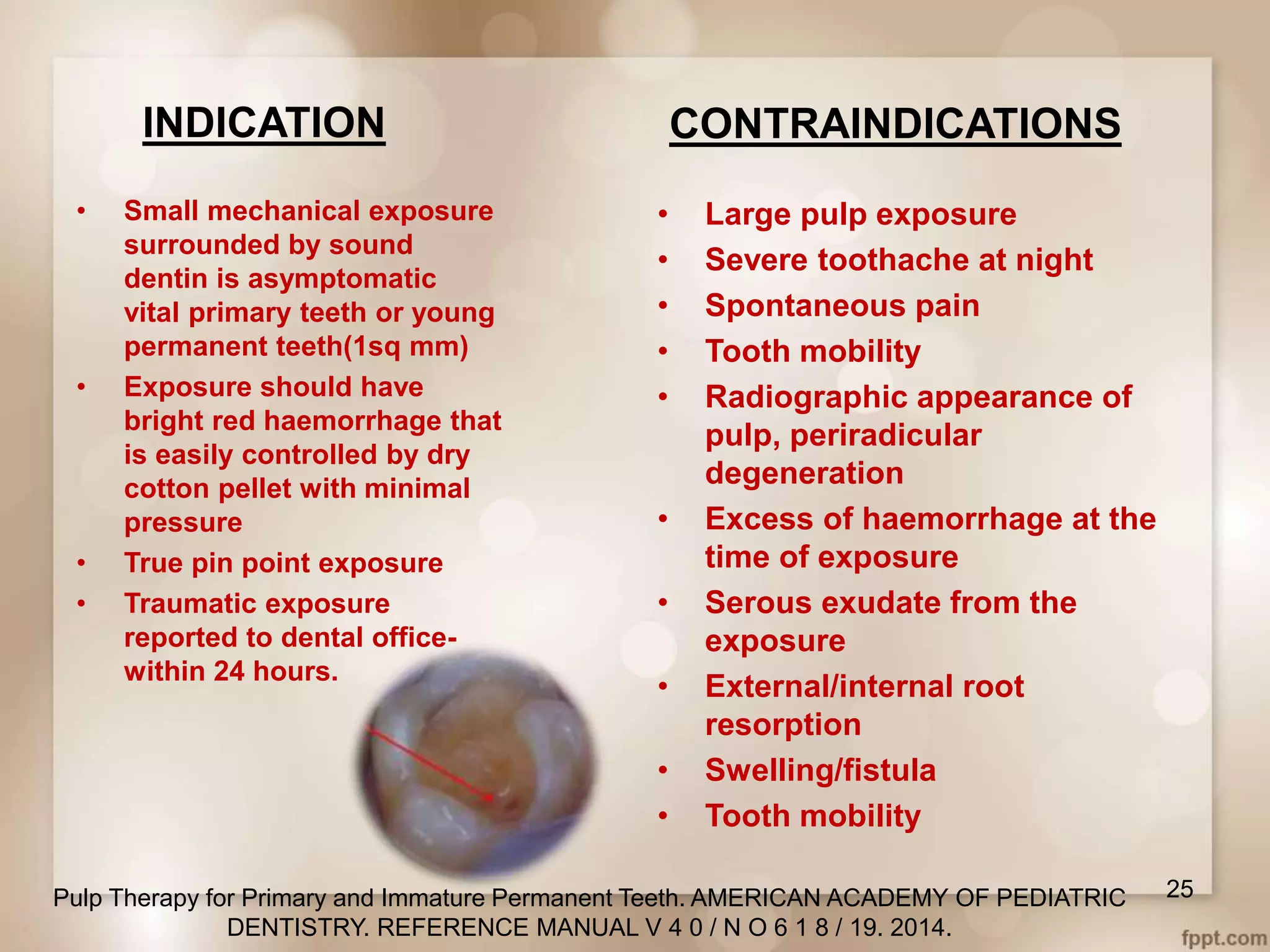 Vital Pulp Therapy | PPT