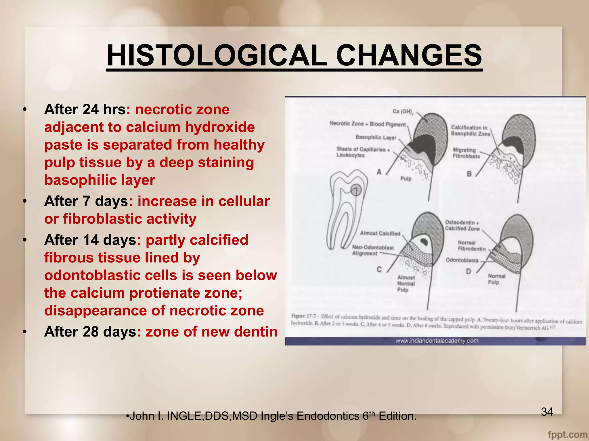 Vital Pulp Therapy | PPT