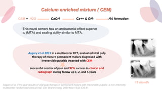 vital pulp therapy.pptx