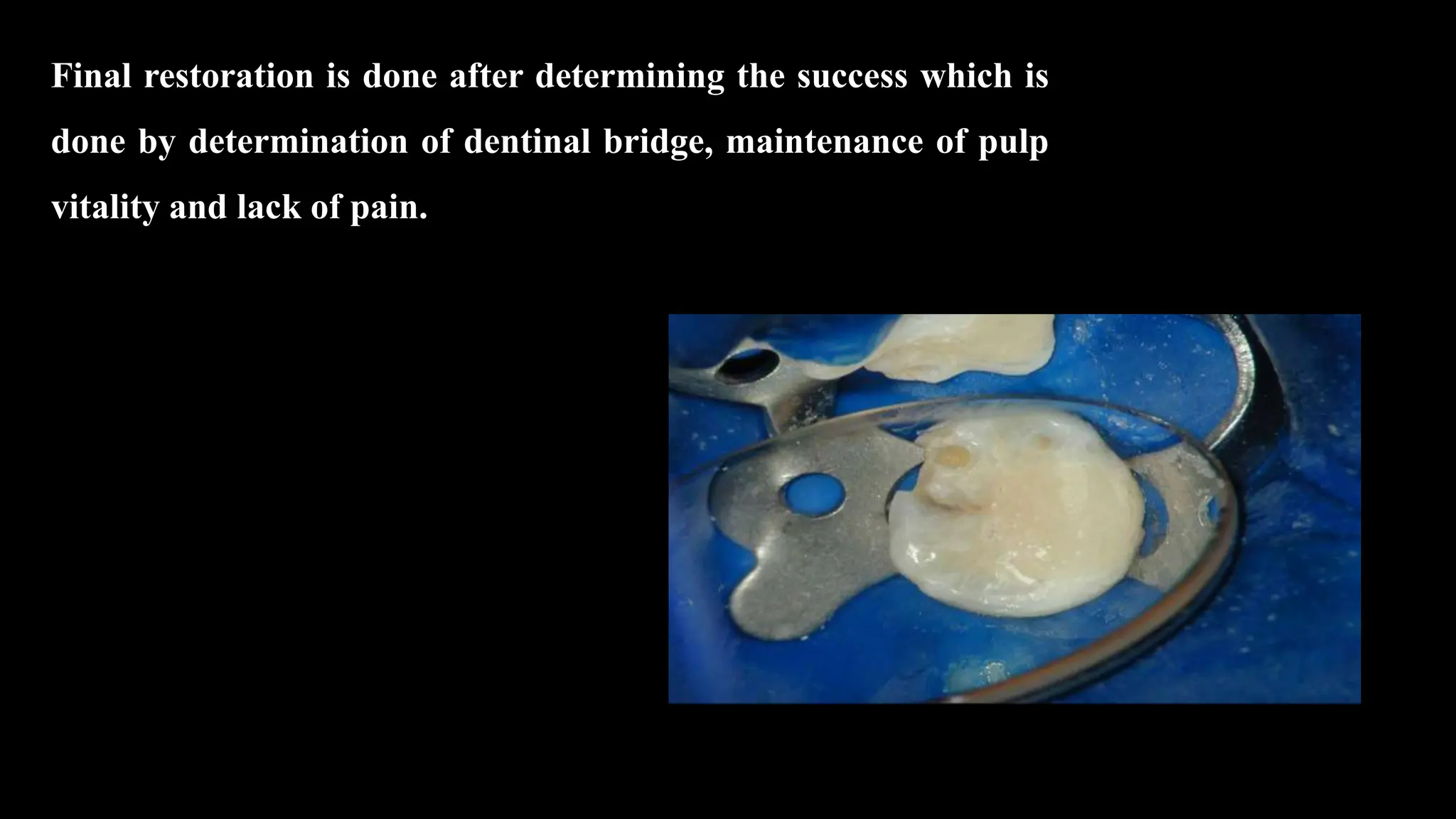 vital pulp therapy.pptx