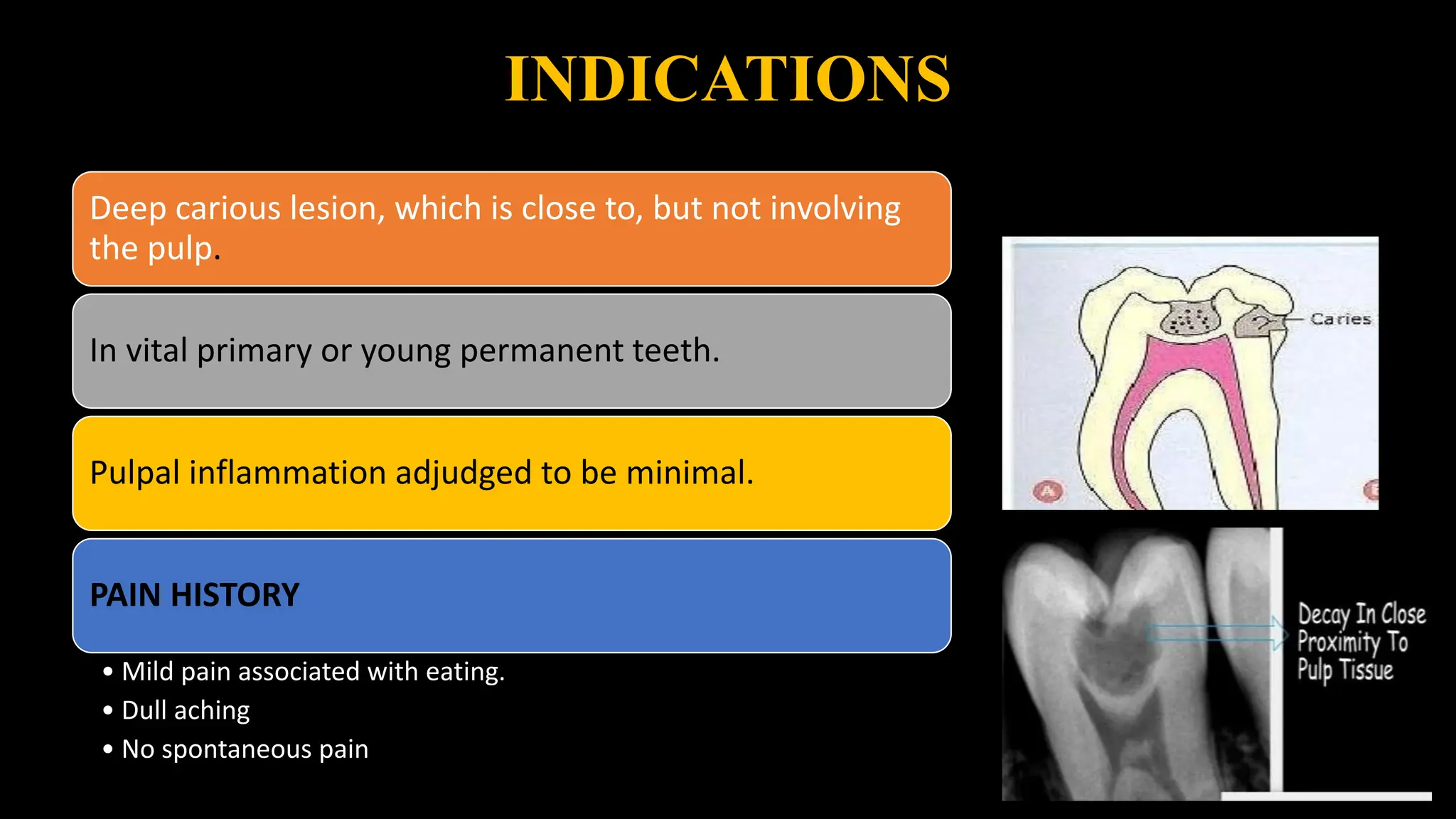 vital pulp therapy.pptx | Dental Health | Diseases and Conditions