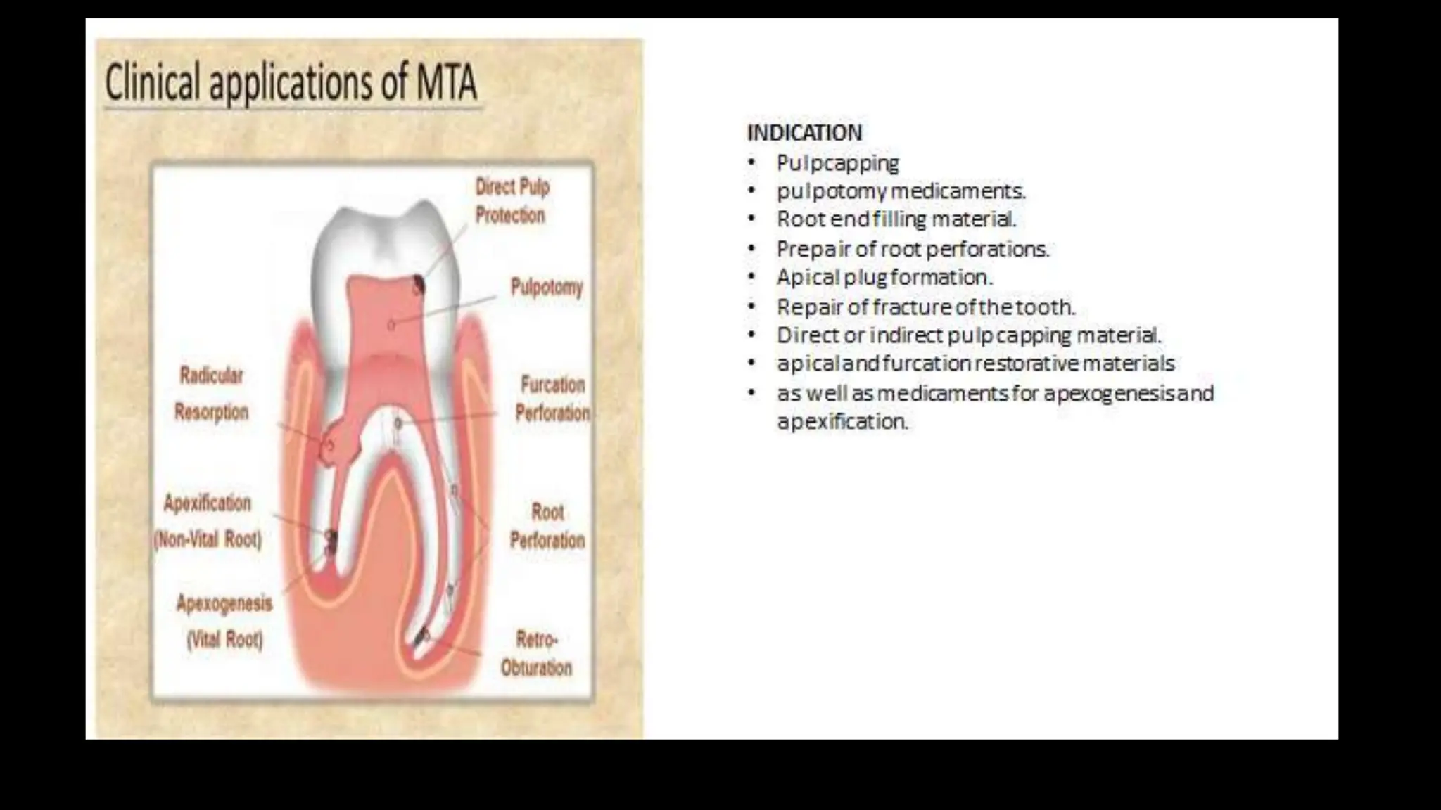 vital pulp therapy.pptx | Dental Health | Diseases and Conditions