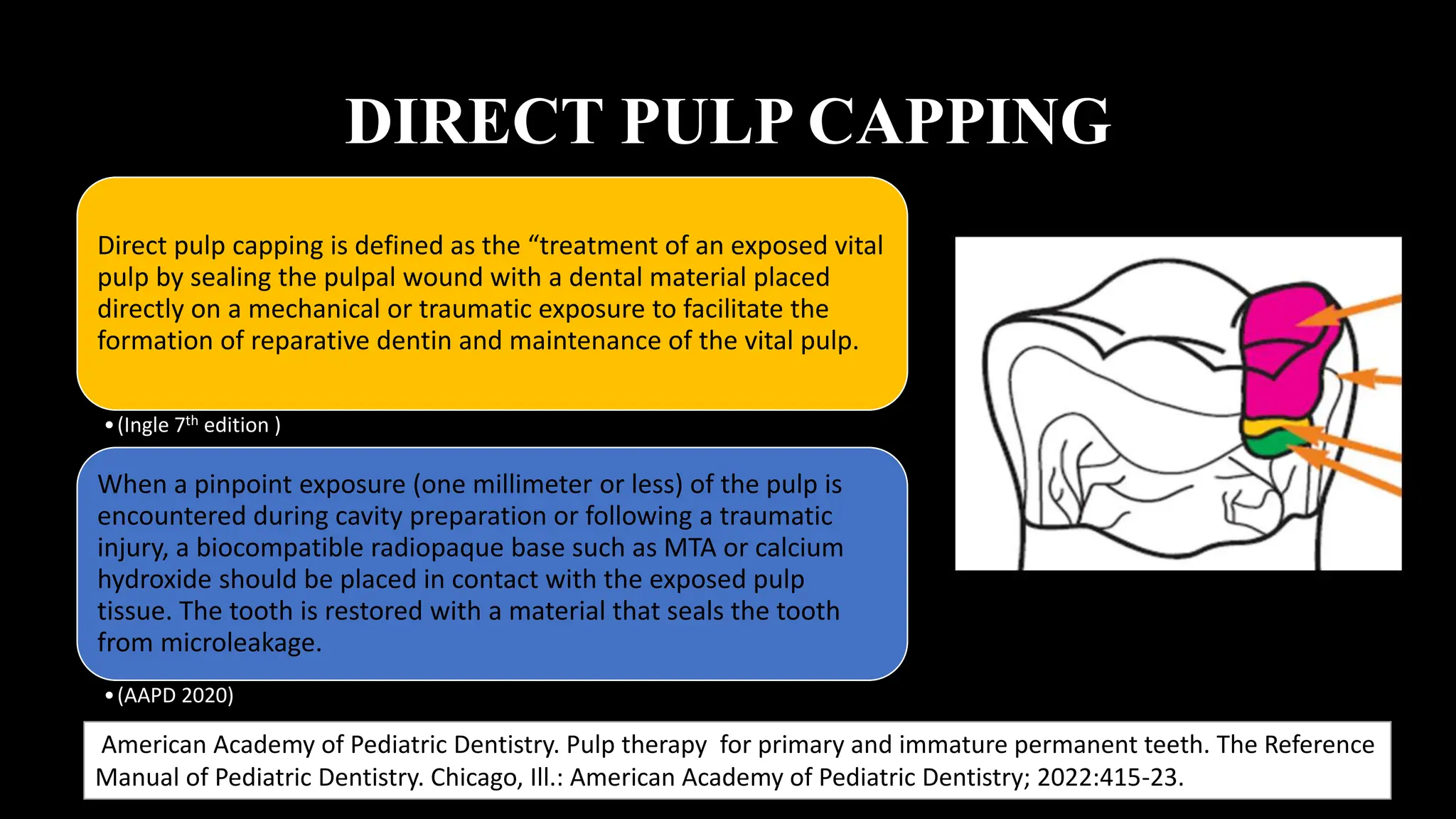 vital pulp therapy.pptx