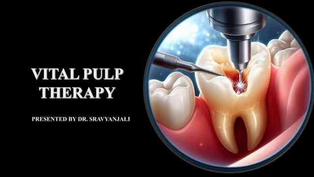 vital pulp therapy.pptx | Dental Health | Diseases and Conditions