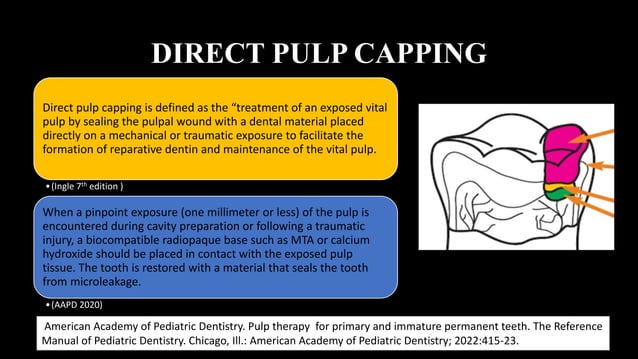 vital pulp therapy.pptx | Dental Health | Diseases and Conditions