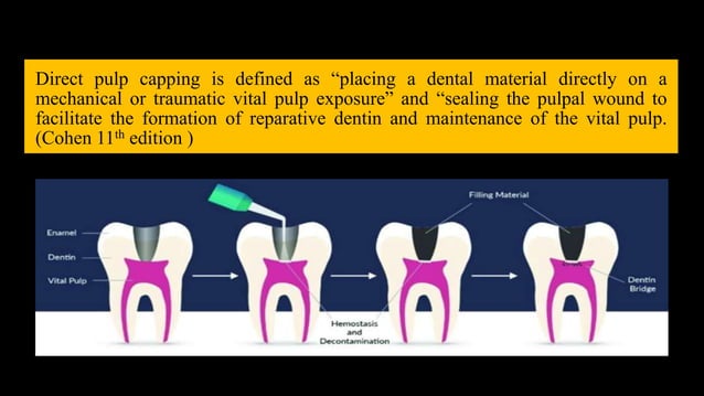 vital pulp therapy.pptx | Dental Health | Diseases and Conditions