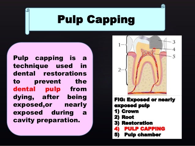 Vital Pulp Therapy In Primary Teeth - TeethWalls