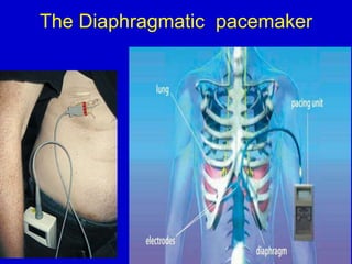 Vital signs respiration | PPT