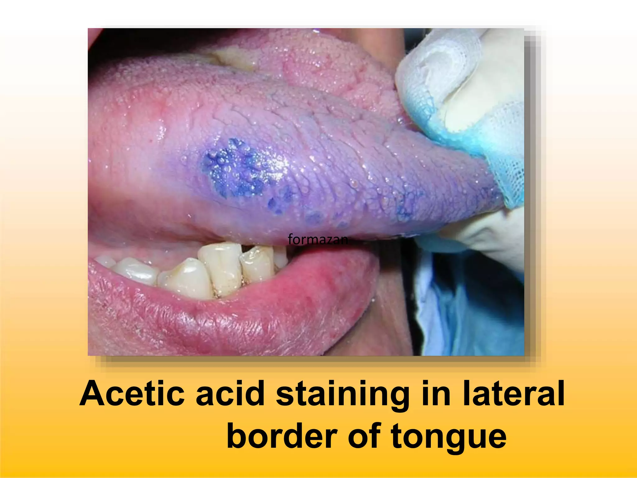 Vital staining ppt notes | PPTX