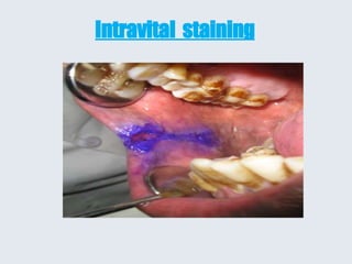 Vital staining ppt notes | PPTX