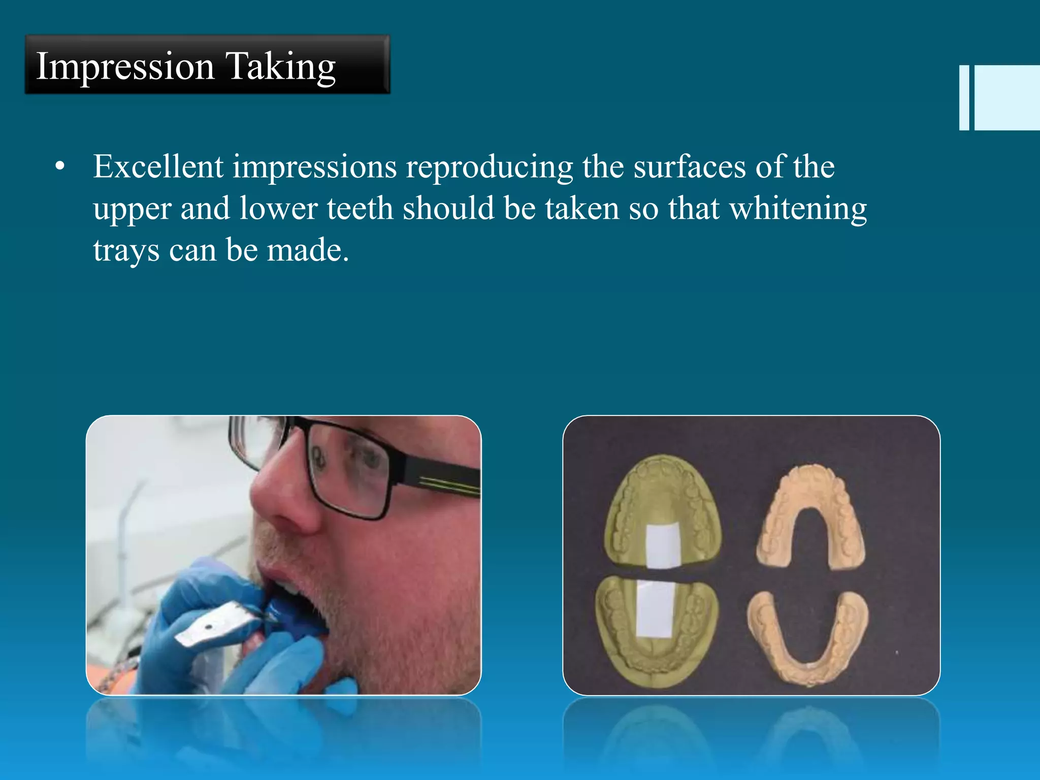 Vital tooth bleaching | PPTX