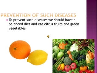 Vitamin c deficiency scurvy | PPTX