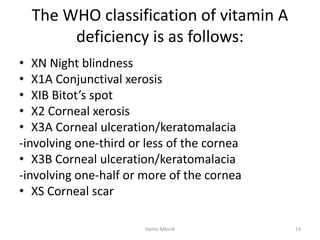Vitamin A defficiency-Hamisi Mkindi.ppt