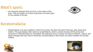 vitamin A.pptx,, metabolism and function | PPTX