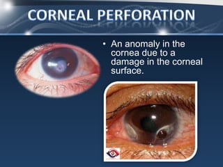 Vitamin A deficiency and its impact on vision | PPTX