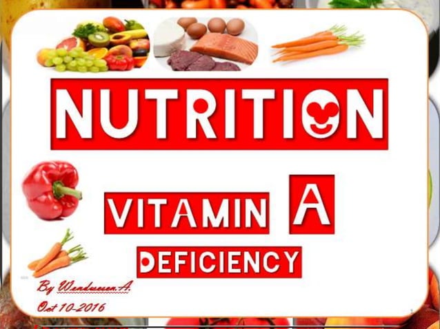 Vitamin A Deficiency | PPT