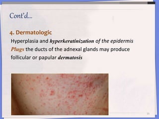 Vitamin A Deficiency | PPTX