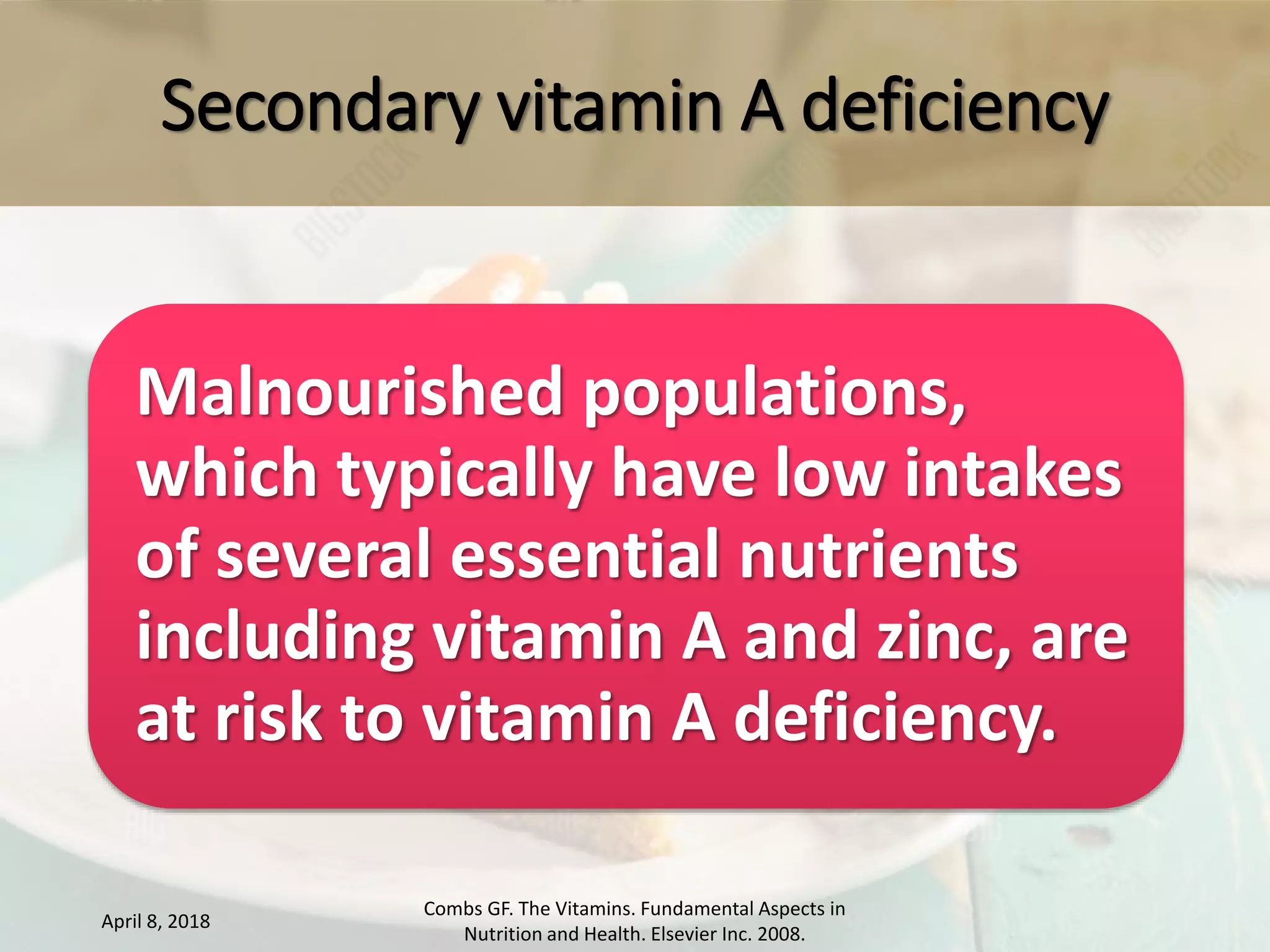 Vitamin A deficiency | PPSX