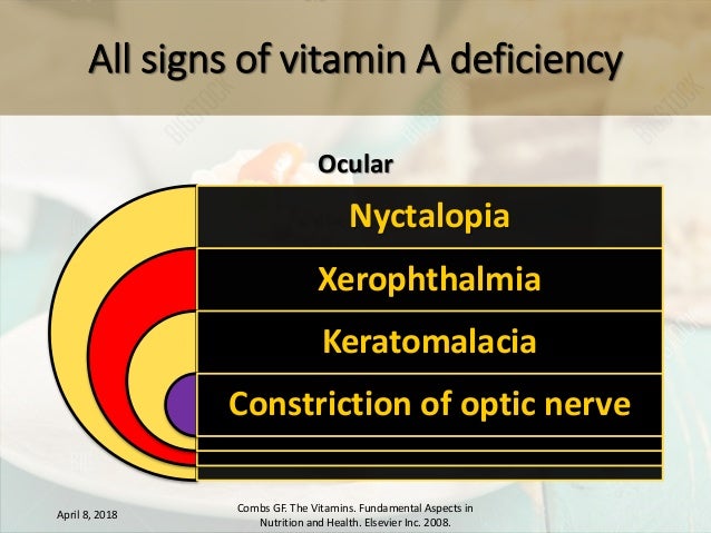 Vitamin A deficiency