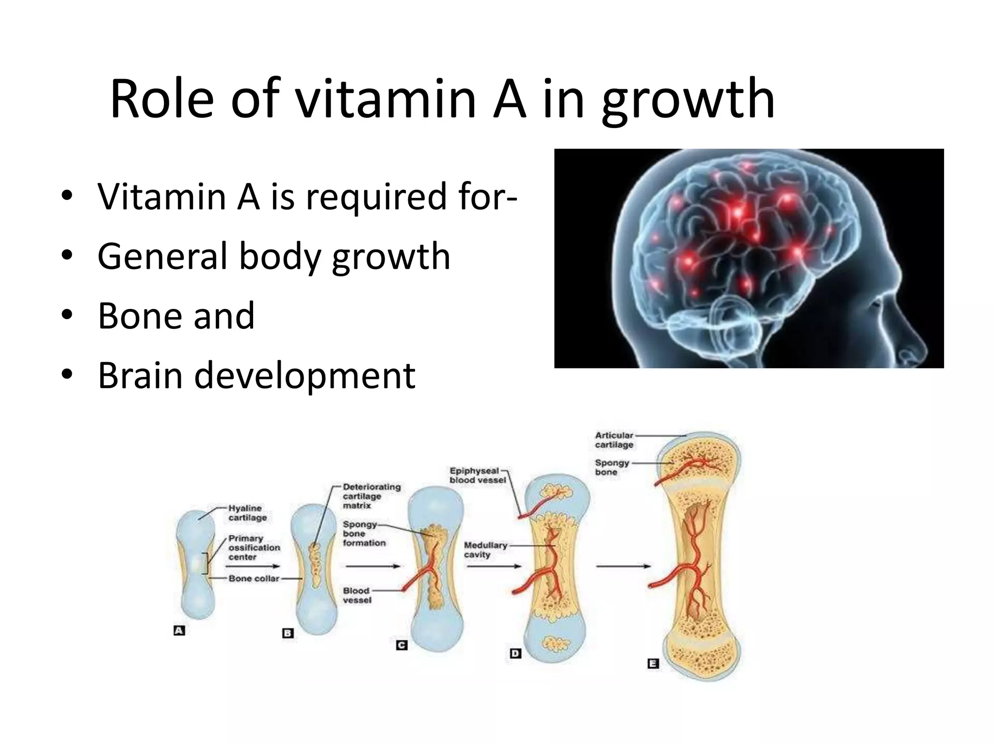 Vitamin A deficiency and control programme | PPTX