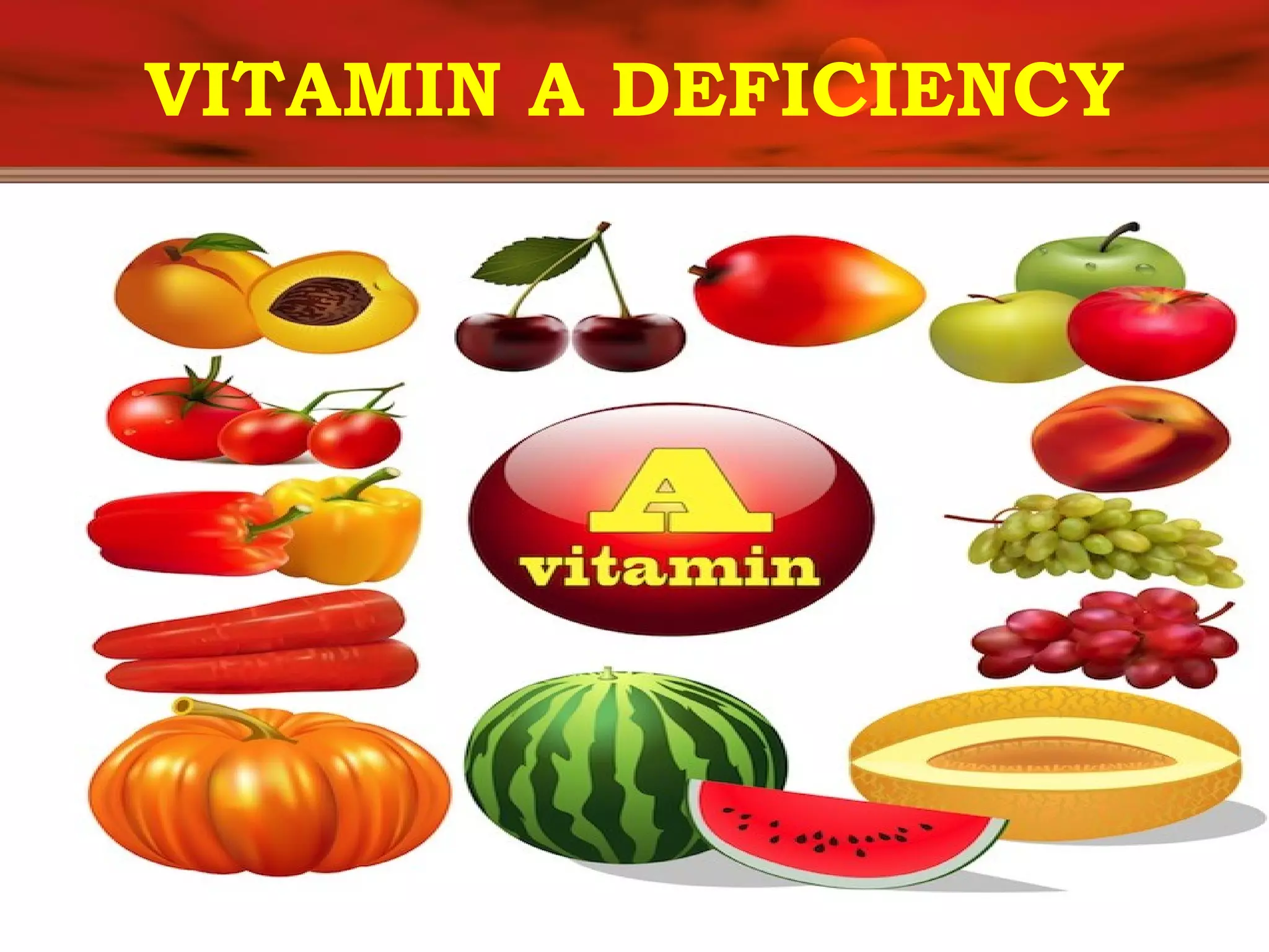 VITAMIN A DEFICIENCY | PPT