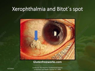 Vitamin A, significance | PPT