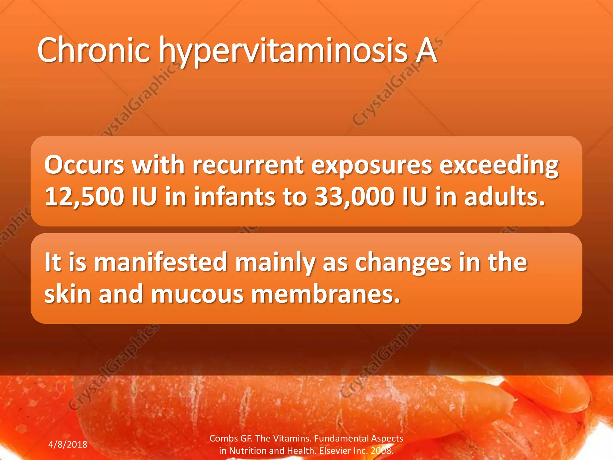 Vitamin A toxicity | PPSX