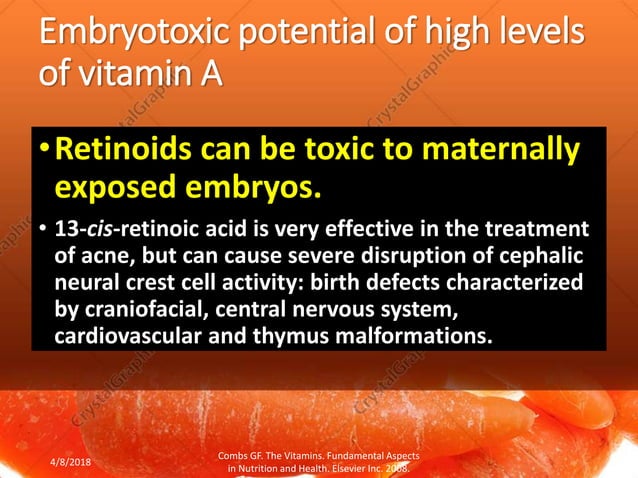 Vitamin A toxicity | PPT